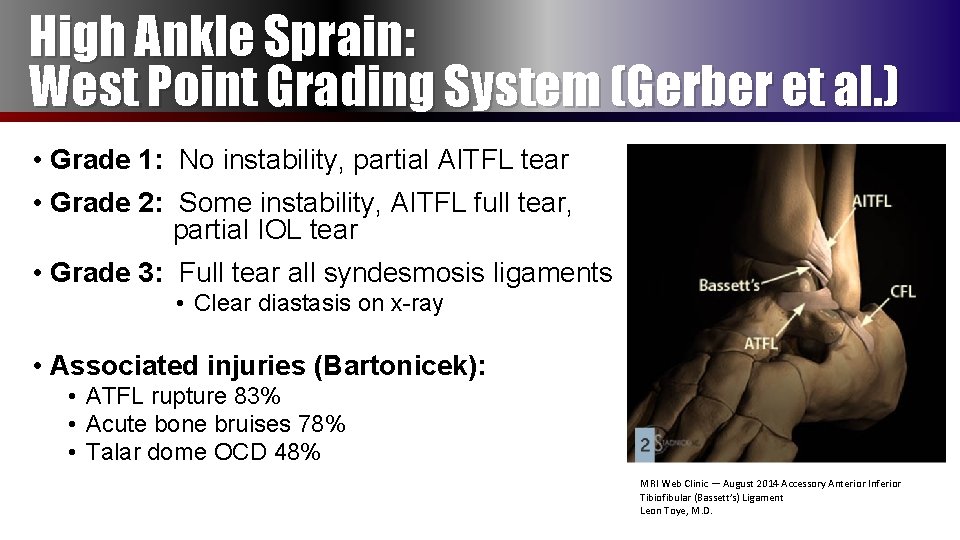 High Ankle Sprain Initial XRays Mortise lateral talar