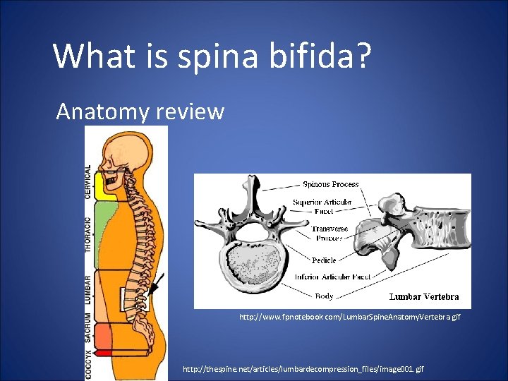 Spina Bifida Biology of Neurodevelopmental Disorders January 24