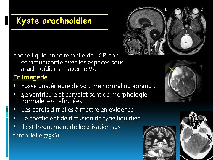 Les malformations crbrales Dr Ajbal Pr Basraoui Plan