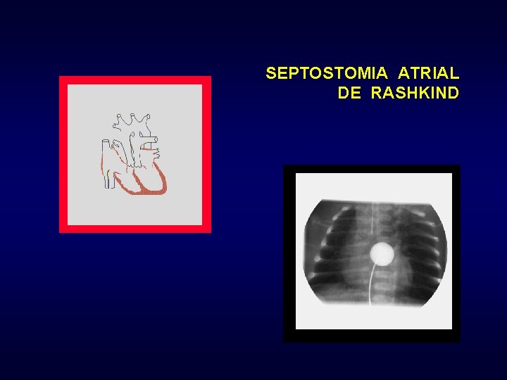 CARDIOLOGIA INFANTIL CARDIOPATIAS CONGENITAS Cardiopatas Estructurales ...