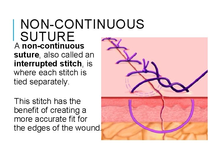 SUTURING Animal Science SUTURES Sutures are used to
