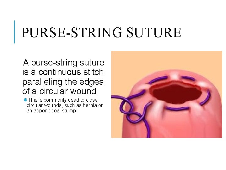 SUTURING Animal Science SUTURES Sutures are used to
