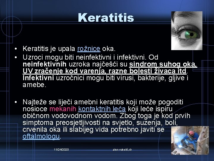 11242020 alen vukeli dr Keratitis Keratitis je upala