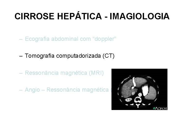 CIRROSE HEPTICA CIRROSE HEPTICA ETIOLOGIA Causas mais frequentes
