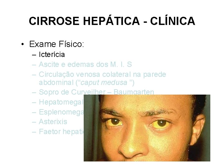 CIRROSE HEPTICA CIRROSE HEPTICA ETIOLOGIA Causas mais frequentes