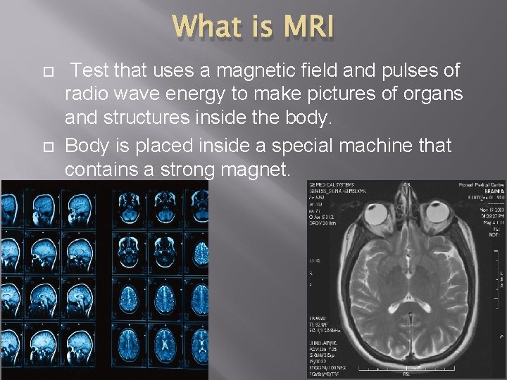 MRIMAGNETIC RESONANCE IMAGING By Prashil Patel What is