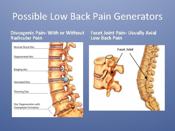 Icd 10 Code For Low Back Pain Compassren