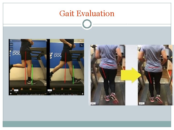 Foot and Ankle Exam with Gait Analysis Review
