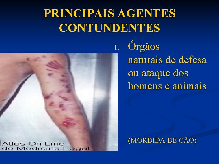 TRAUMATOLOGIA FORENSE a parte do Medicina Legal que