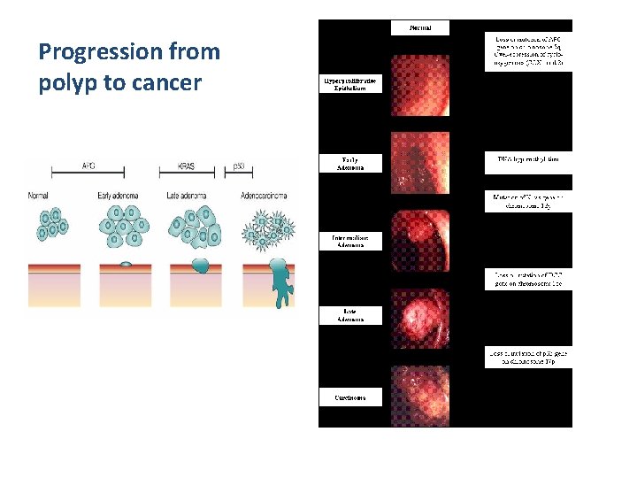 Adenoma Detection Sheila E Crowe MD FRCP Professor