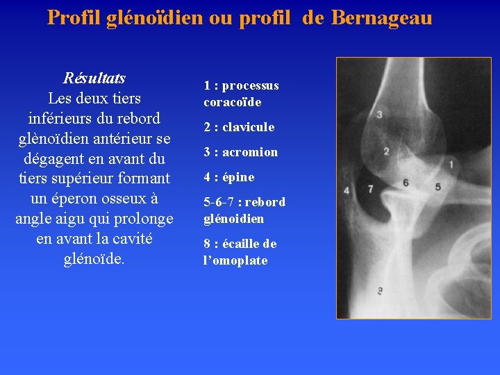 ANATOMIE RADIOLOGIQUE DE LEPAULE STRUCTURES OSSEUSES de lpaule