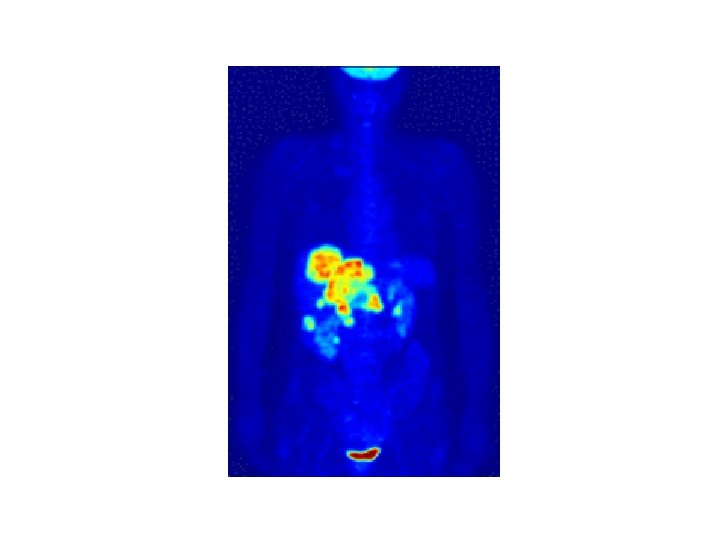 Lesson 14 Radiotracers Introduction Basic principle All isotopes