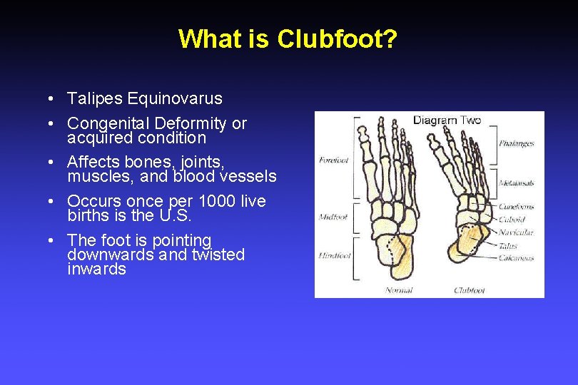Bae Orthotics Clubfoot Orthotic William Porter Alexis Wickwire