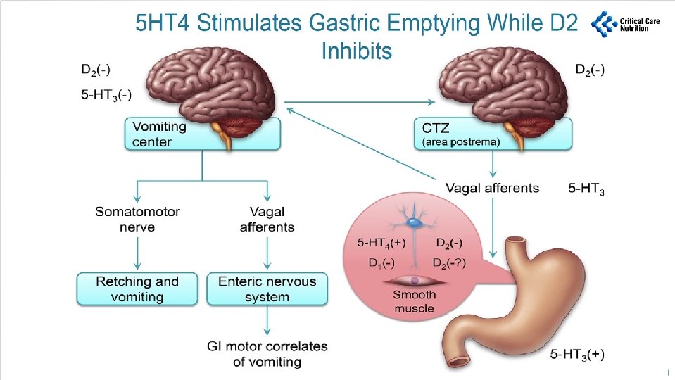 Strategies to Improve Feeding Intolerance Daren K Heyland