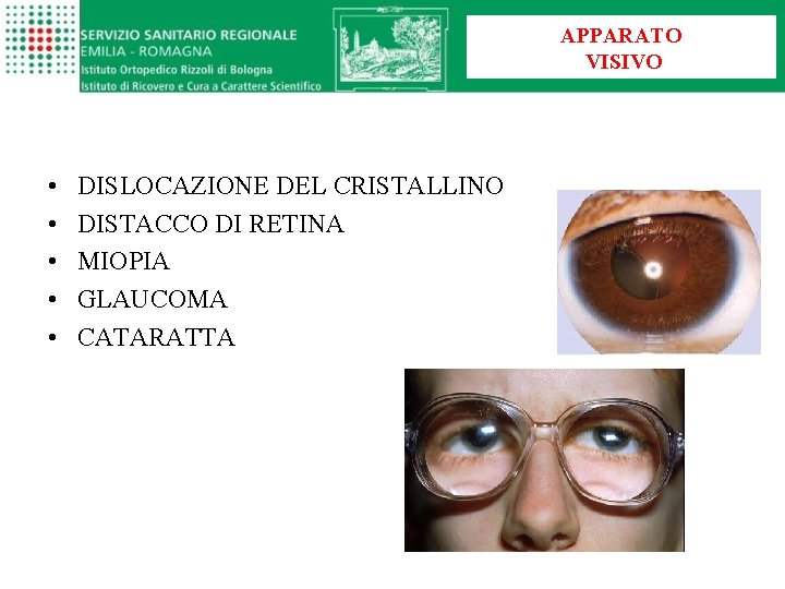 SINDROME DI MARFAN CLINICA E RIABILITAZIONE Isabella Fusaro