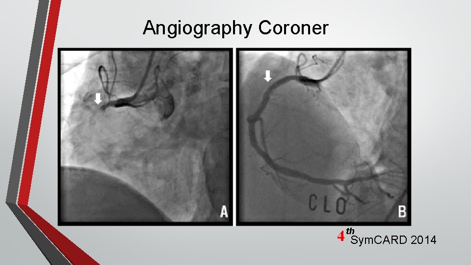 th 4 Sym CARD 2014 Up Date on
