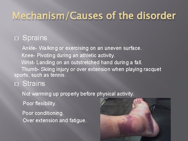 SPRAINS STRAINS DISLOCATIONS AND FRACTURES By Devin Peters