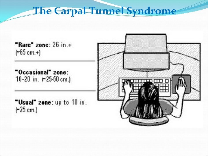 The Carpal Tunnel Syndrome For all computer users