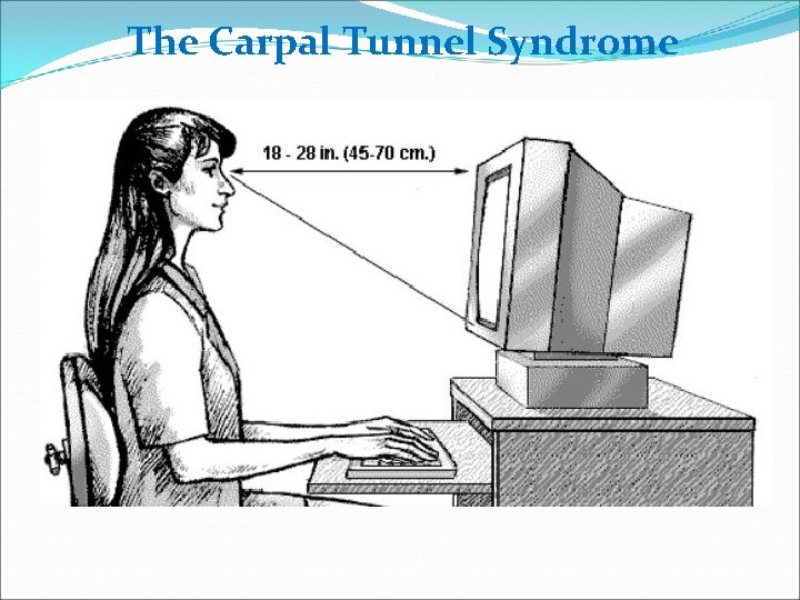 The Carpal Tunnel Syndrome For all computer users