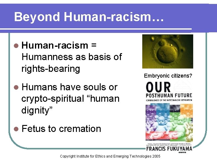 What is Transhumanism James J Hughes Ph D