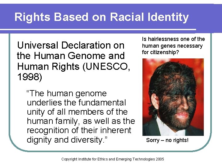 What is Transhumanism James J Hughes Ph D