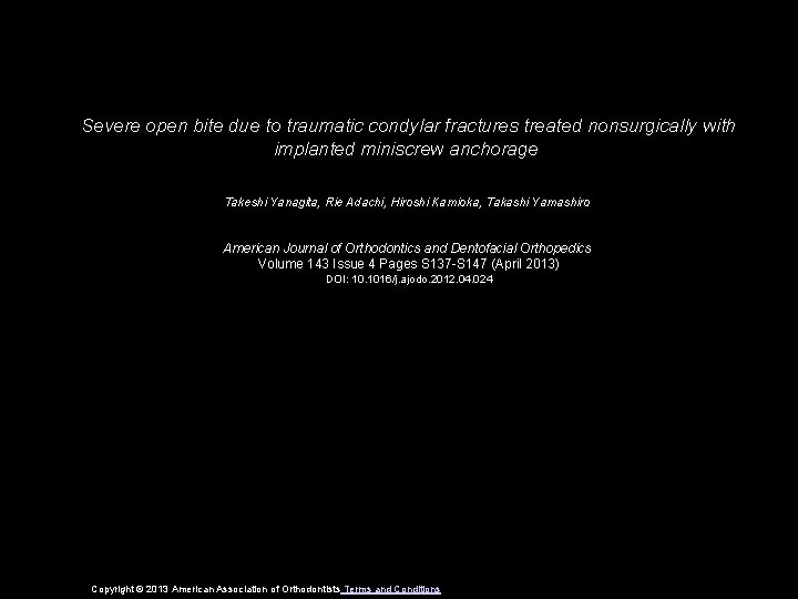 Severe open bite due to traumatic condylar fractures