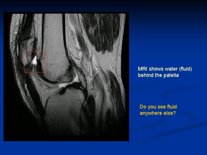Imaging the Musculoskeletal System The Extremities Richard L