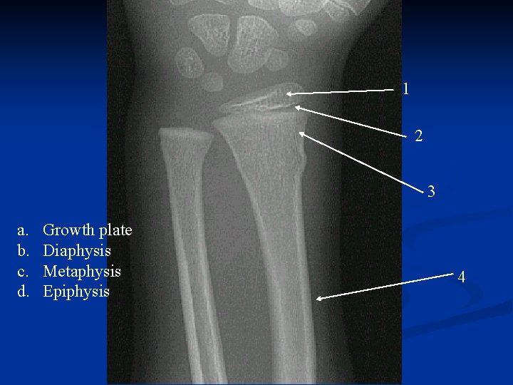 Imaging the Musculoskeletal System The Extremities Richard L