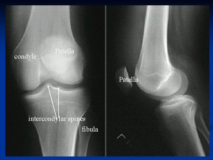 Imaging the Musculoskeletal System The Extremities Richard L