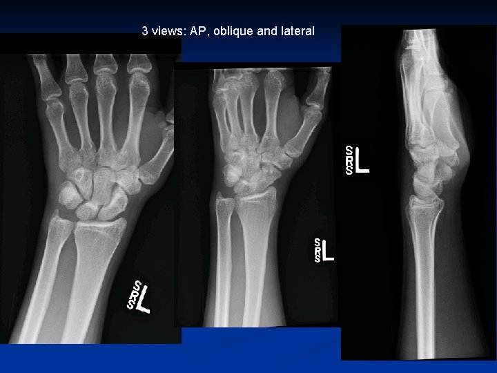 Imaging the Musculoskeletal System The Extremities Richard L