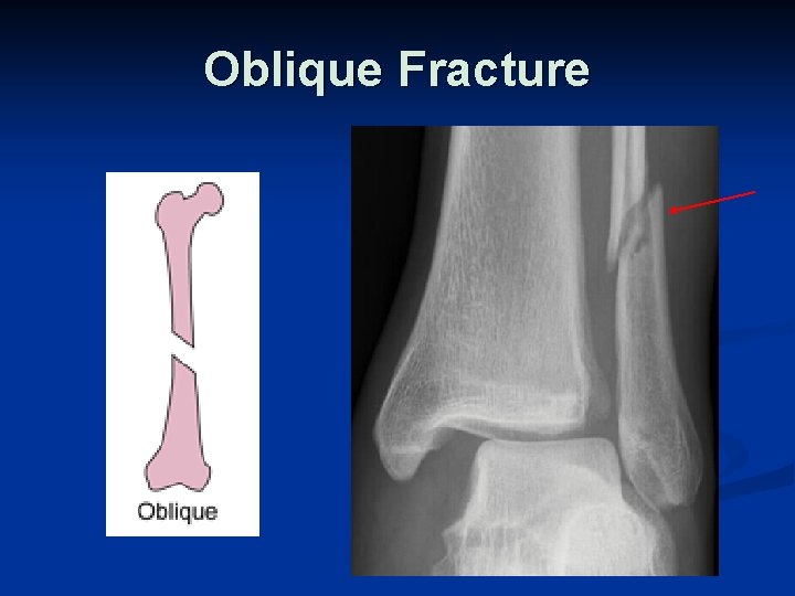 Imaging the Musculoskeletal System The Extremities Richard L