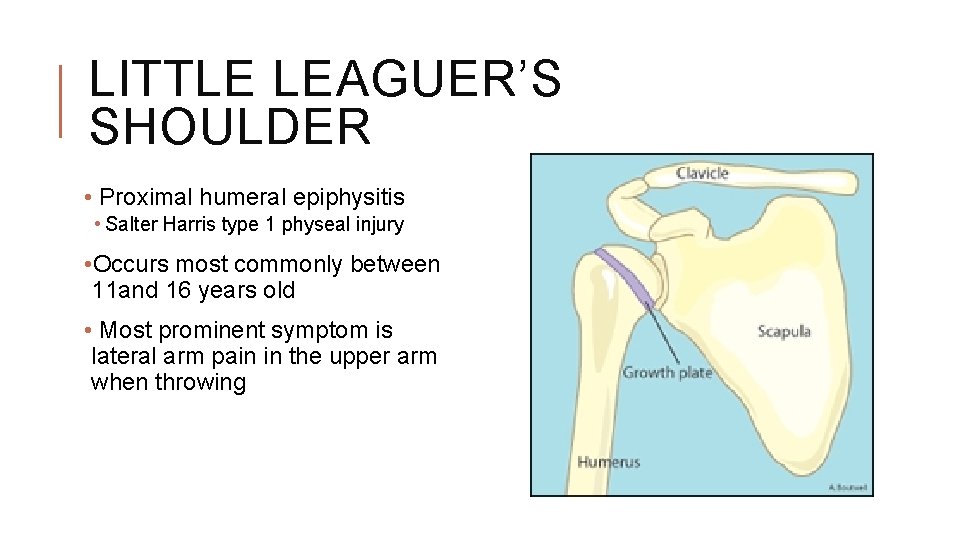 OVERUSE INJURIES IN THE ERA OF SPORT SPECIALIZATION