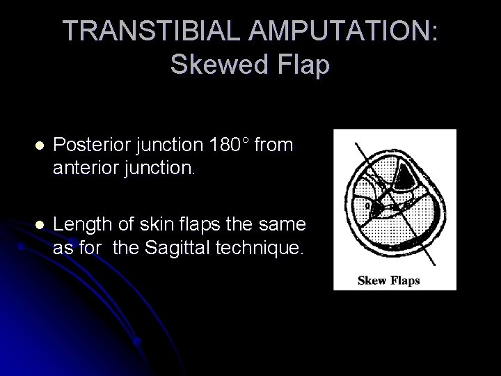 TRANSTIBIAL SURGICAL TECHNIQUE A Review and Panel Discussion