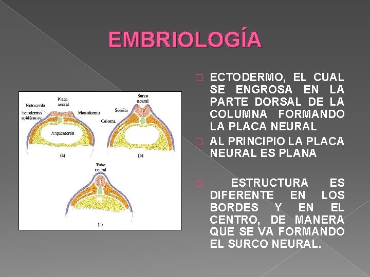 MIELOMENINGOCELE AUTOR MORELIA HERNANDEZ COORD DRA DAICY ROJAS