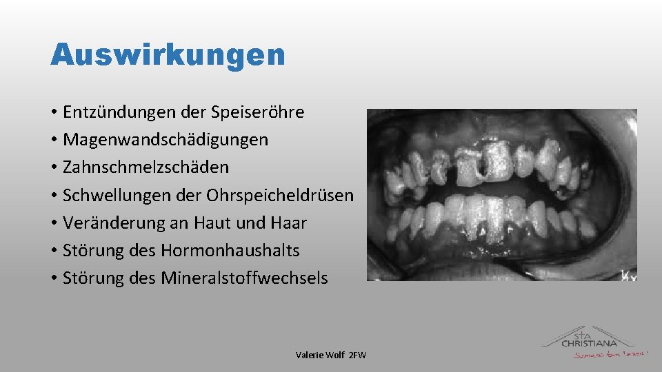 BULIMIE EssBrechsucht Valerie Wolf 2 FW Definition EssBrechsucht