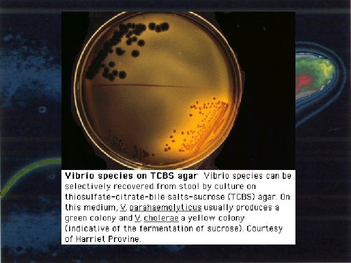 Vibrio cholerae Vibrio cholerae Introduction History ...