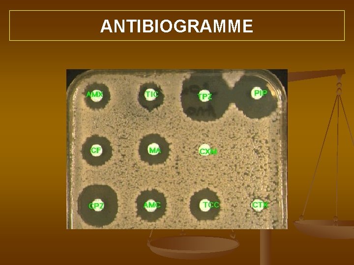 LES CYSTITES Soins Infirmiers SCHMAS DE LARBRE URINAIRE