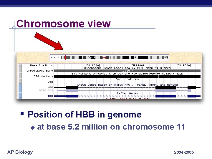 Using Bioinformatics in Medicine Sickle Cell Anemia the