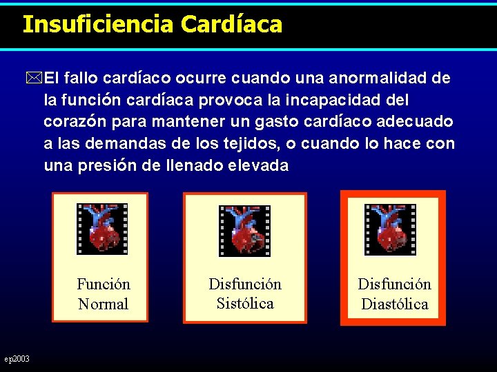 Insuficiencia Cardaca El fallo cardaco ocurre cuando una