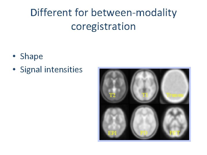 Coregistration and Spatial Normalisation Ana Saraiva Britt Hoffland