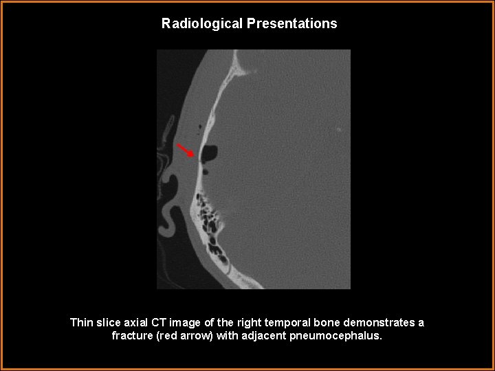 Radiological Category Neuroradiology Principal Modality 1 CT Principal