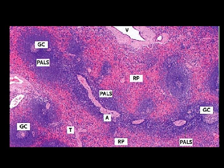 Organi del Sistema Immunitario Tonsille ed Adenoidi Timo