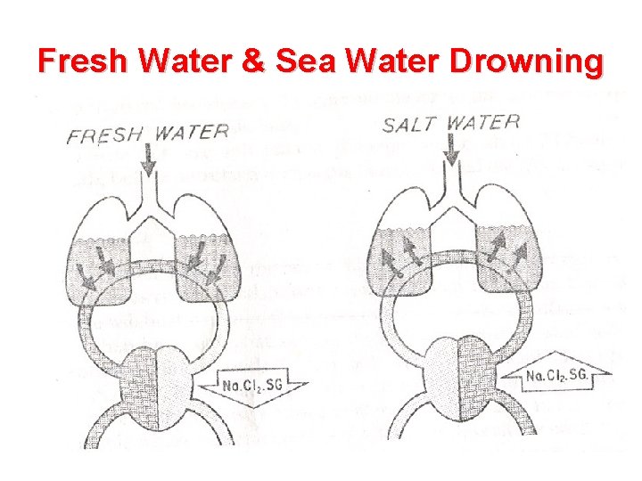 Drowning Lesson 5 By Dr Nadir Ali Rana
