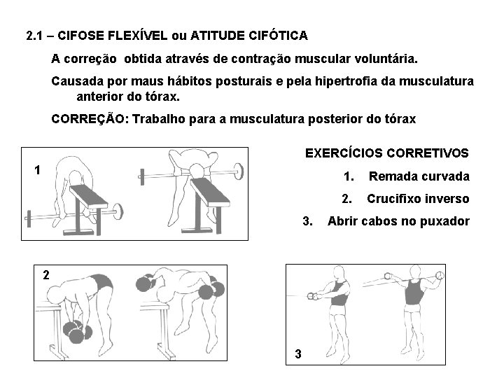 DESVIOS POSTURAIS 1 LORDOSE CERVICAL Acentuao da concavidade