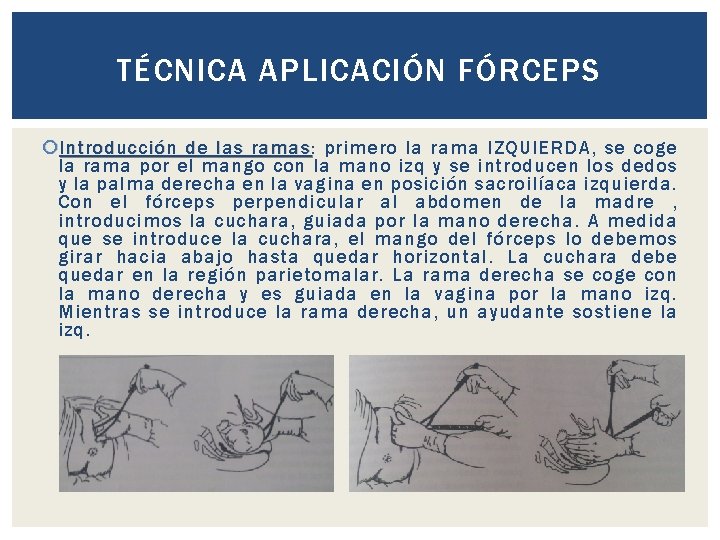 FRCEPS MNICA MORN CARREIRA MIR I HGU GREGORIO