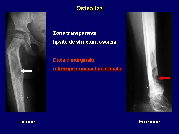 Sistem OSTEOARTICULAR Modificari de parti moi De dimensiune