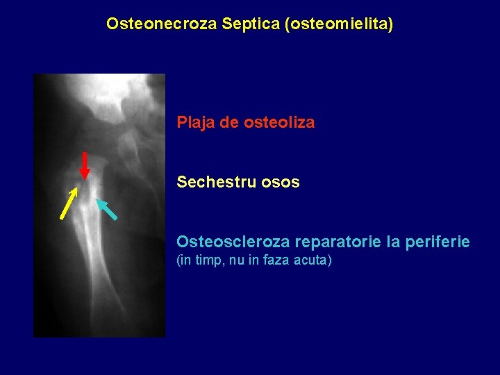 Sistem OSTEOARTICULAR Modificari de parti moi De dimensiune