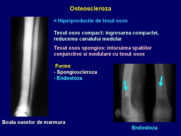 Sistem OSTEOARTICULAR Modificari de parti moi De dimensiune