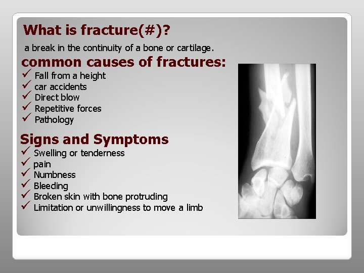 RAD 422 Lecture 4 Fractures Types Complications and