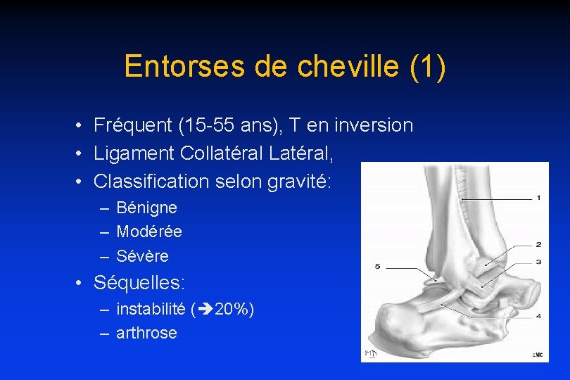 TRAUMATISMES DE LA CHEVILLE Traumatismes de la cheville